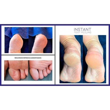 INSTANT FOOT PEELING DELUXE KIT LOVA SKIN